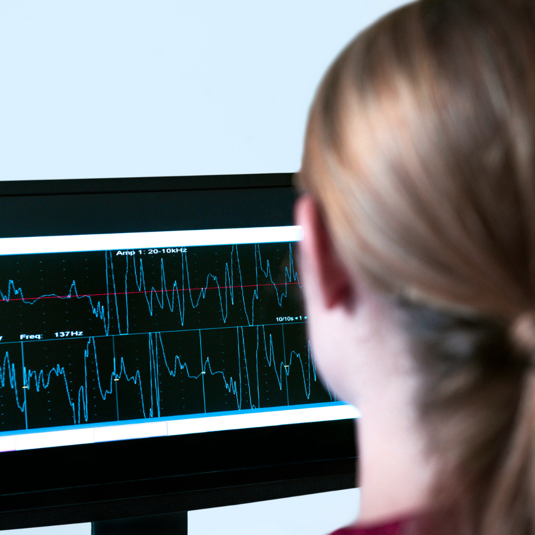 What is an EMG Test? - Nassau Suffolk Neurology